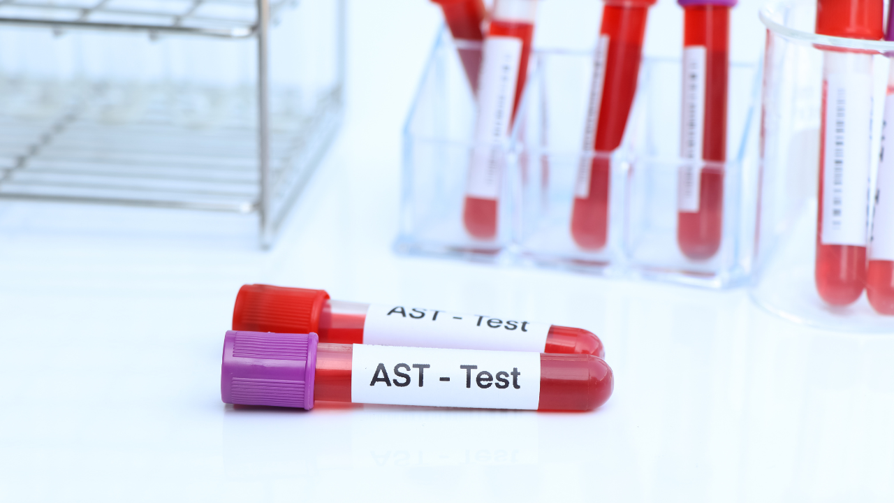 My Blood Test Showed High Levels of LD and AST, Could you have Liver ...